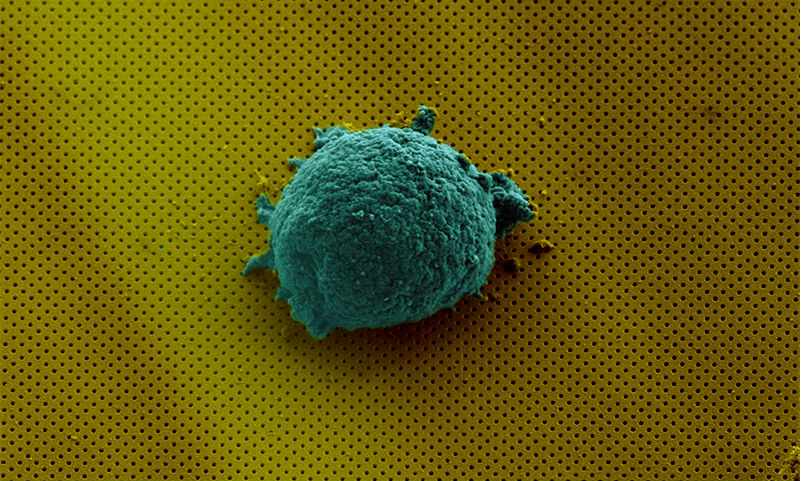 Cell chat: Attacking disease by learning the language of cells - RMIT ...